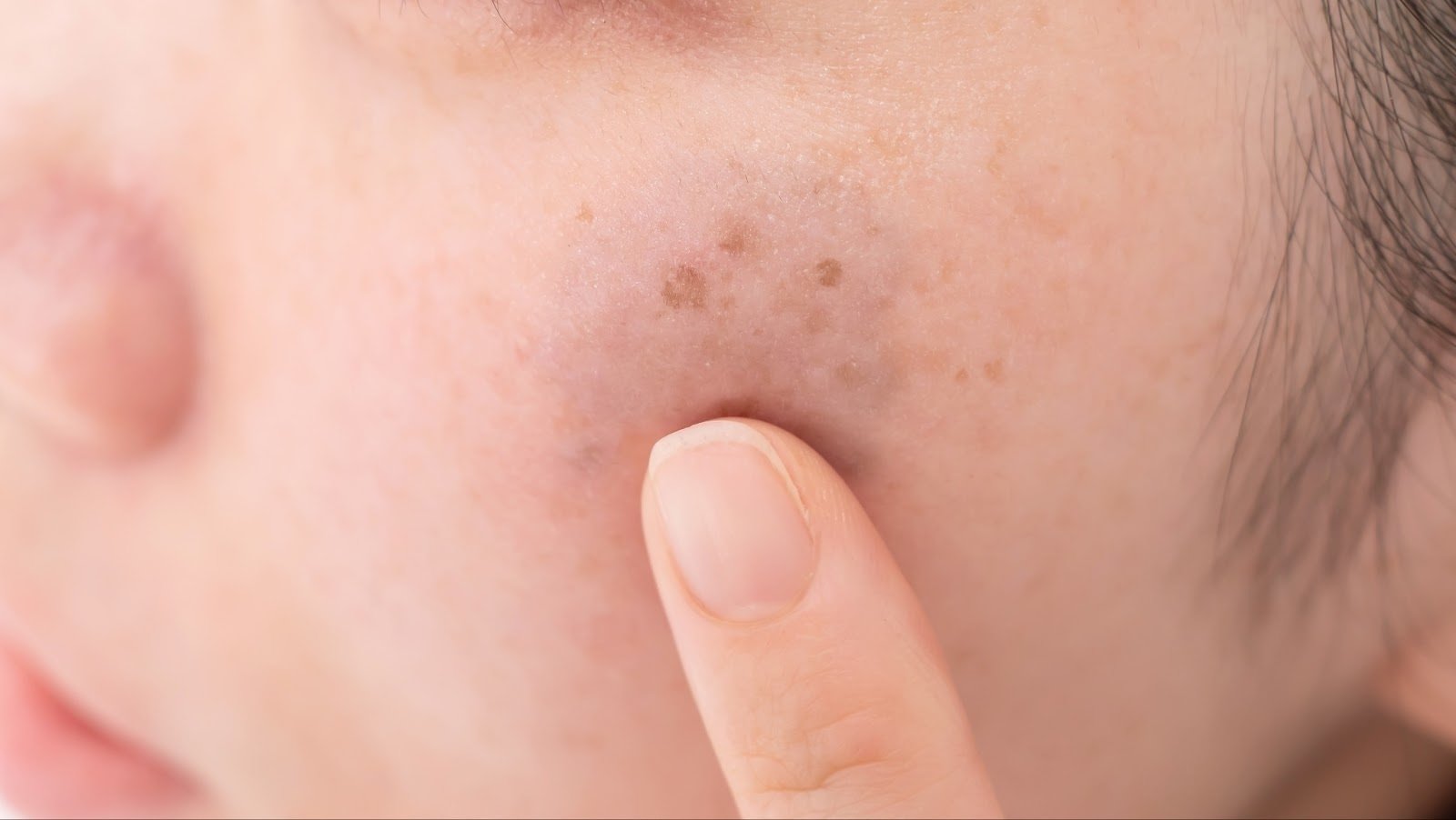 Blasensteine – Ursachen und Behandlung - Gesundheitsreport.com